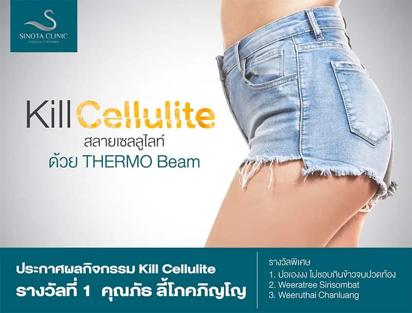 รางวัล Kill Cellulite! รับผลลัพธ์กำจัดเซลลูไลท์ พร้อมตอบโจทย์สภาพผิวของคุณ